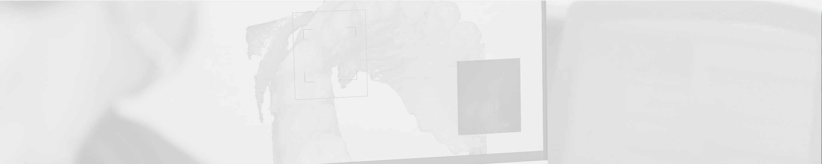 Gum Recession Treatment in River Edge, NJ - Advanced Periodontics of ...